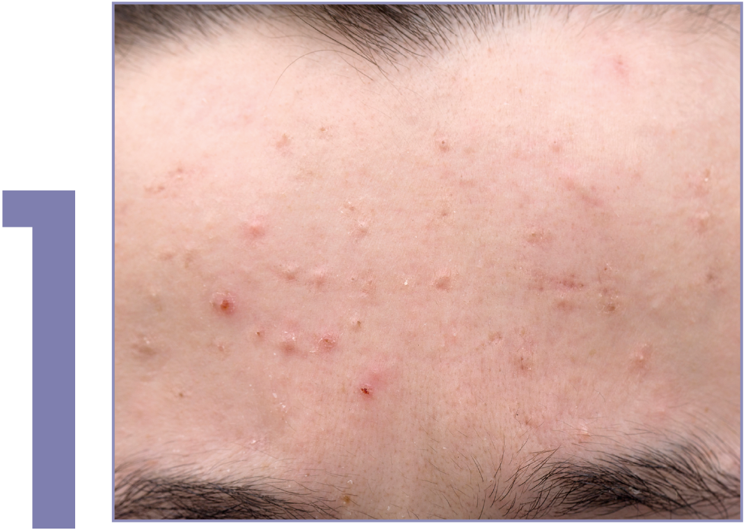 EU-Leitlinie & Selektive Therapien