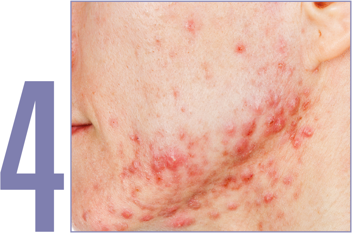 EU-Leitlinie & Selektive Therapien