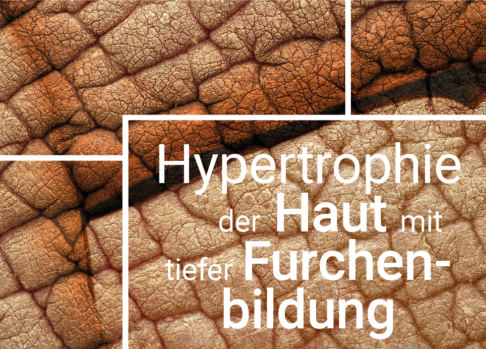 Ursachen der verdickten Haut