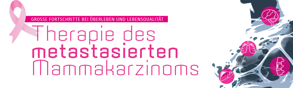 Therapie des metastasierten Mammakarzinoms