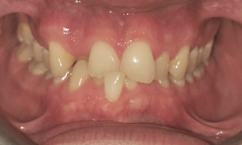 Stunning Before & After Dental Treatment Photos! 😳