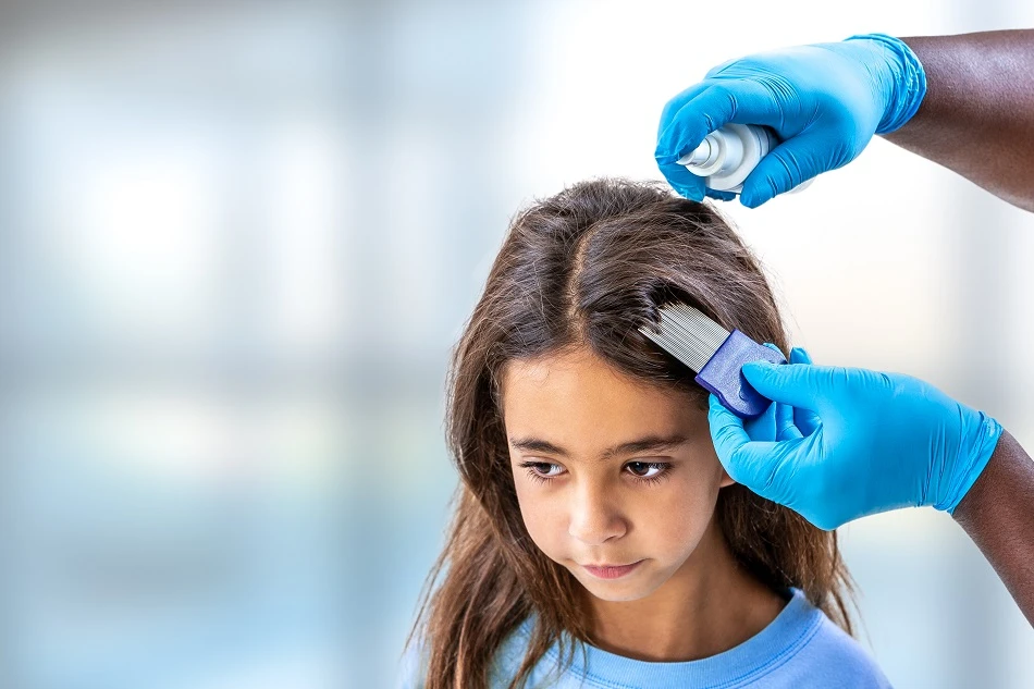 Unmasking the Mystery: Why Do Lice Keep Coming Back? | LiceDoctors