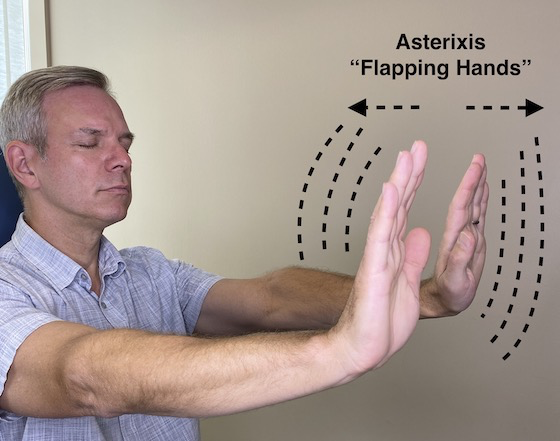 Insuficiência hepática aguda: causa, diagnóstico e tratamento