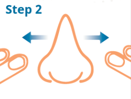 2 Step Cottle Test: Assess Nasal Congestion