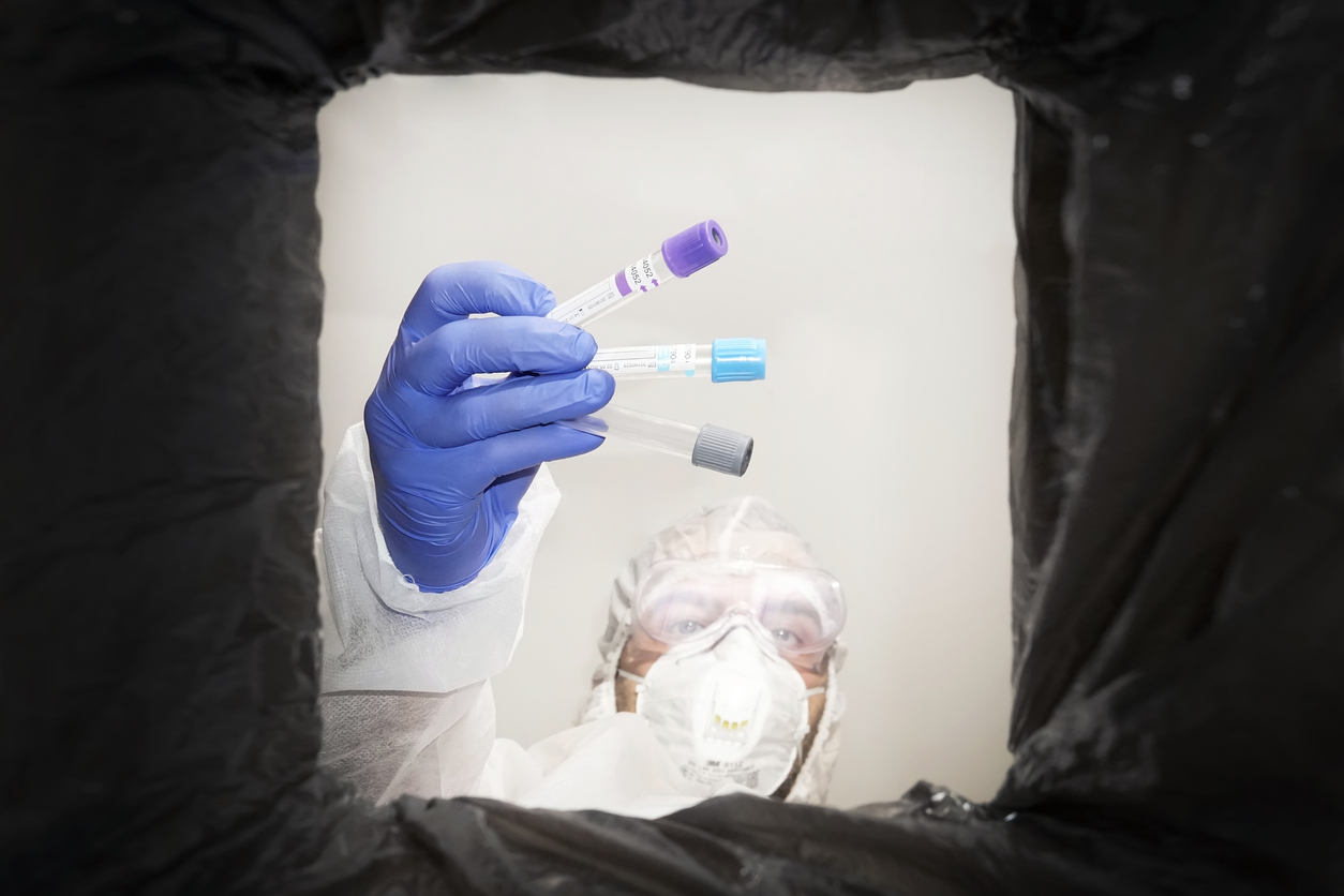 The Impact of Poor Sample Management – Slope Blog