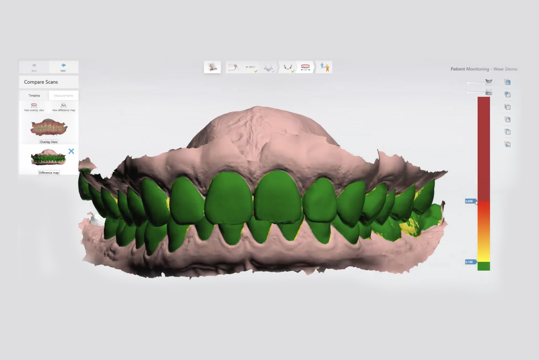 SCANNER INTRAORAL 3SHAPE TRIOS 3