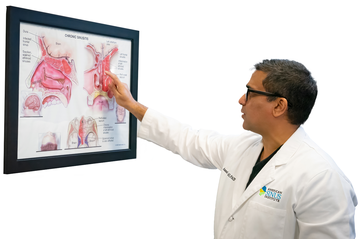 What is Sinusitis - American Sinus Institute - San Antonio