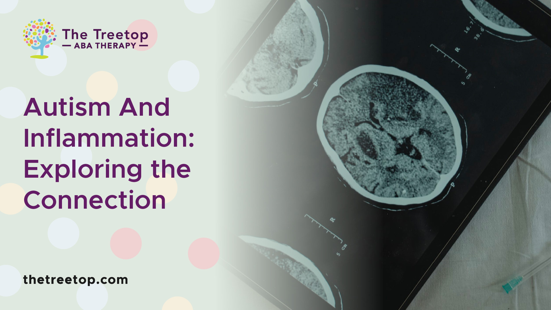 Autism And Inflammation: Exploring the Connection