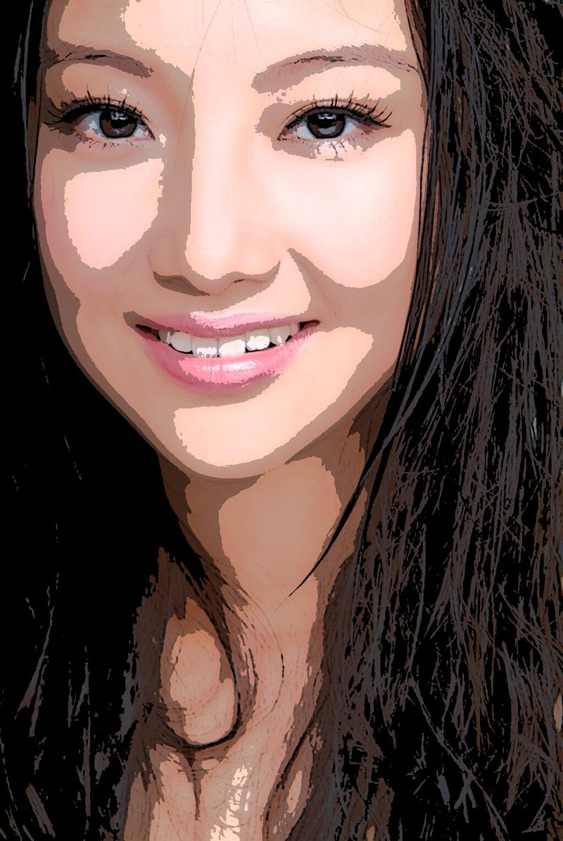 Asian Brow Lift Sydney | Eyebrow Lift | Forehead Lift