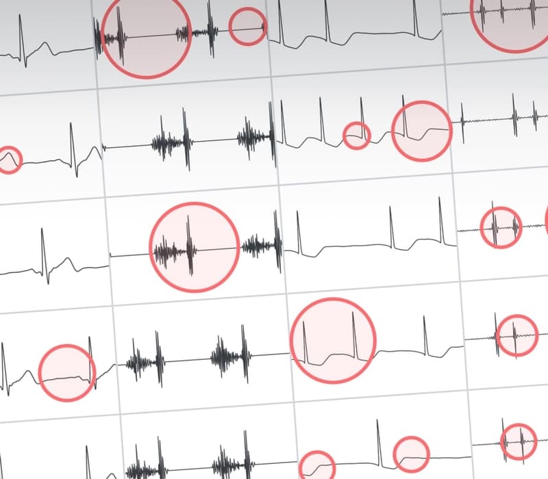 Digital Stethoscopes for Advanced Exams & Virtual Care | Eko