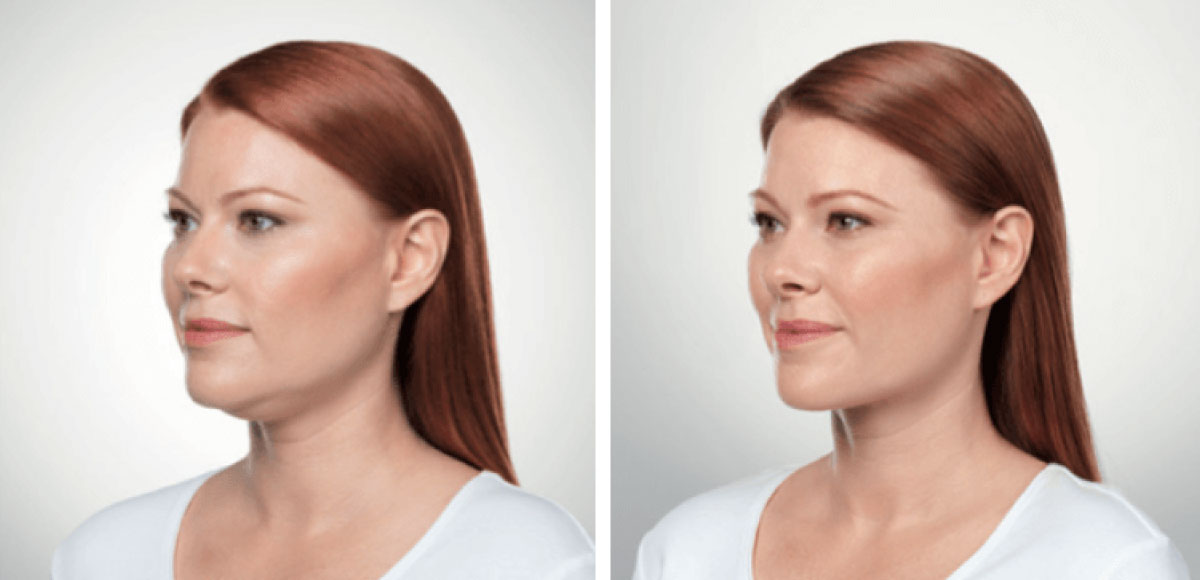 Beverly Hills Rejuvenation Center | Anti-Aging & Med Spa