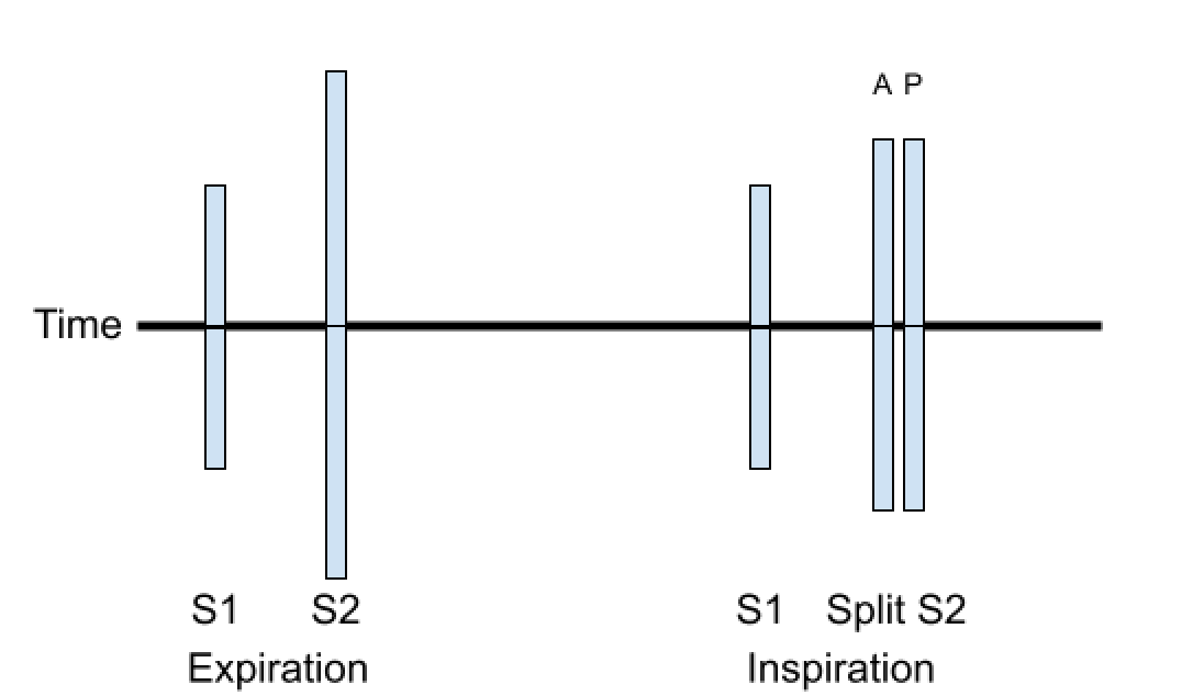 Heart Sounds Diagram S1 S2