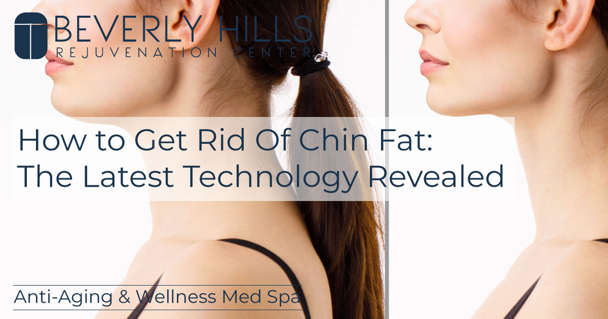 How to Get Rid of Chin Fat | Beverly Hills Rejuvenation Center