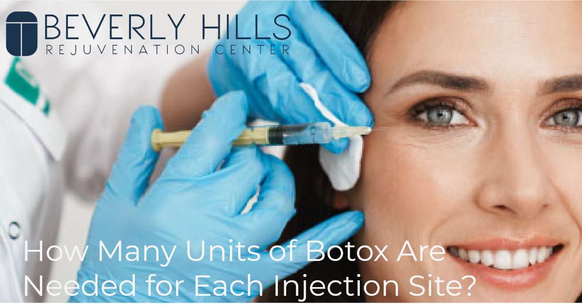 How Many Units of Botox Are Needed for Each Injection Site?