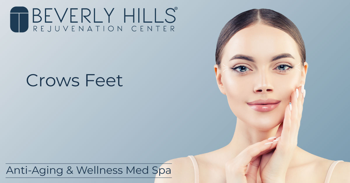 Crows Feet | Beverly Hills Rejuvenation Center