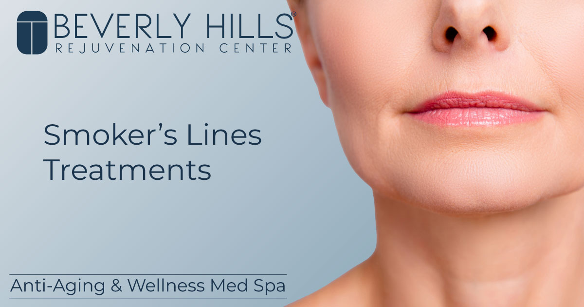 Smoker’s Lines | Beverly Hills Rejuvenation Center