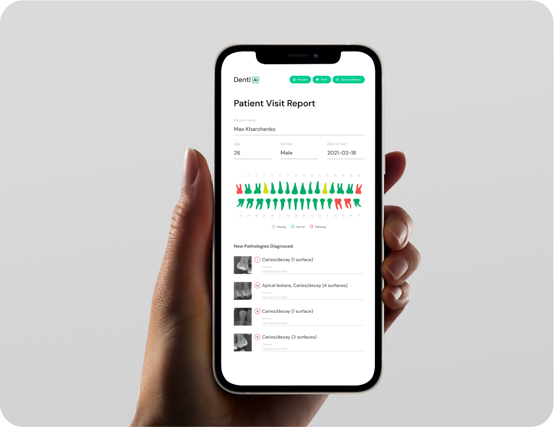 Denti.AI: AI for Dental X-Ray Imaging and Voice Charting