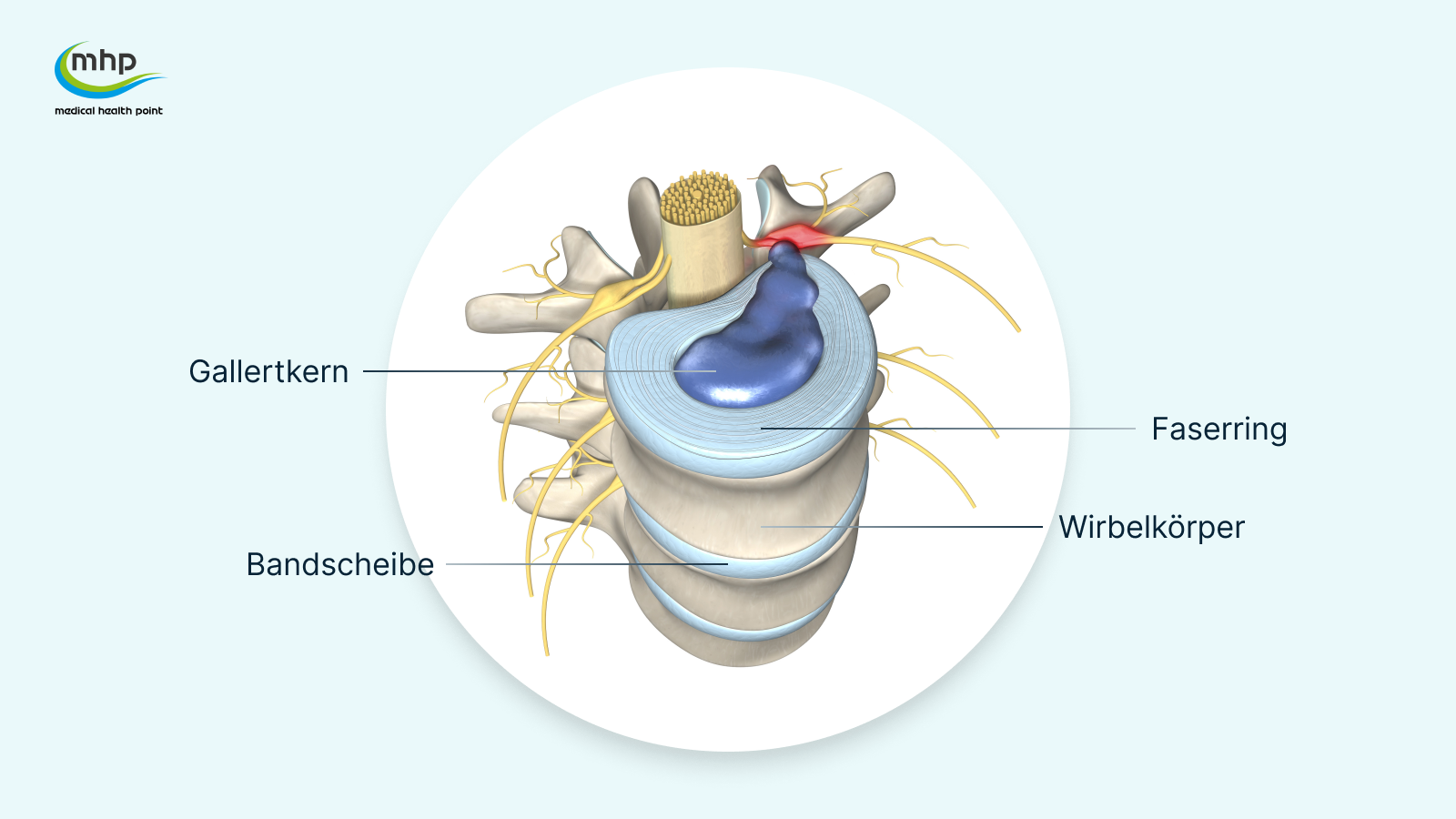 Alles über Bandscheibenvorfall: Ursachen, Symptome und Behandlung