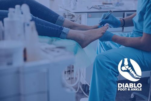 Signs of a Midfoot Sprain | Podiatrist in Walnut Creek