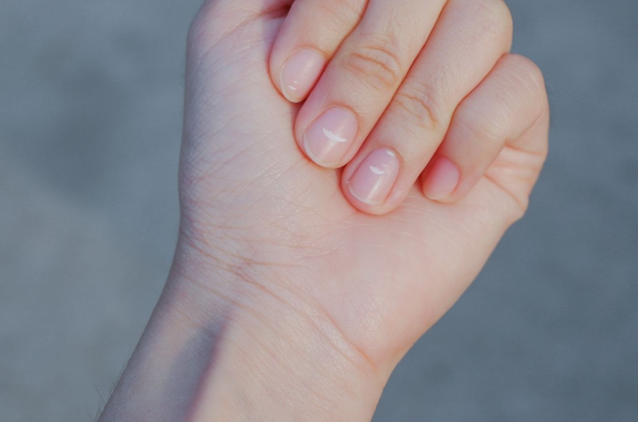 Protein Deficiency Disease: Meaning, Symptoms, Causes & Treatment ...