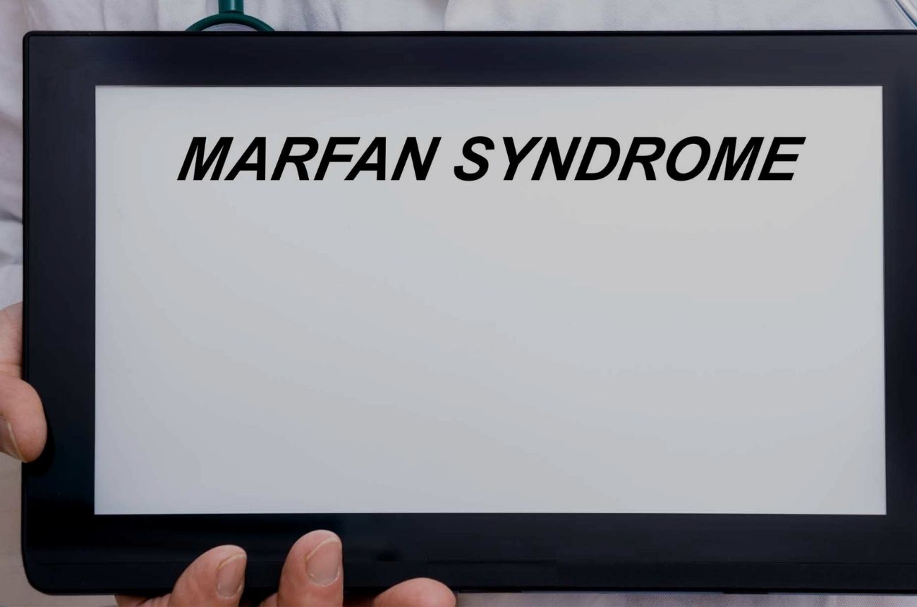 What is Marfan Syndrome? - Symptoms, Causes, Diagnosis, & Treatment At ...