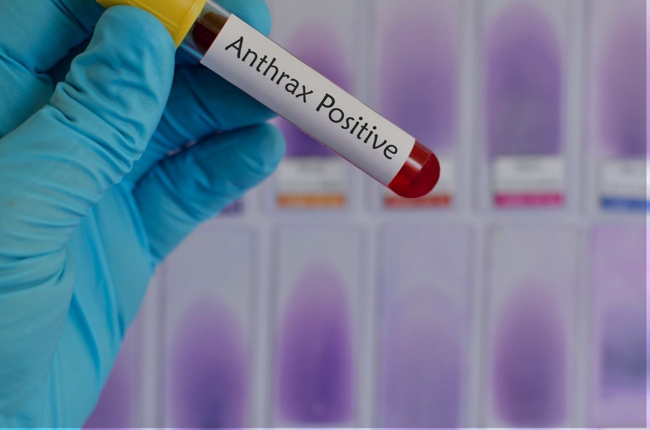 Anthrax : Types, Symptoms, Causes, Treatment & Prevention - cult.fit