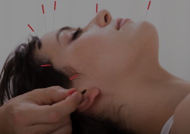 Acupuncture Hub - Gold Coast