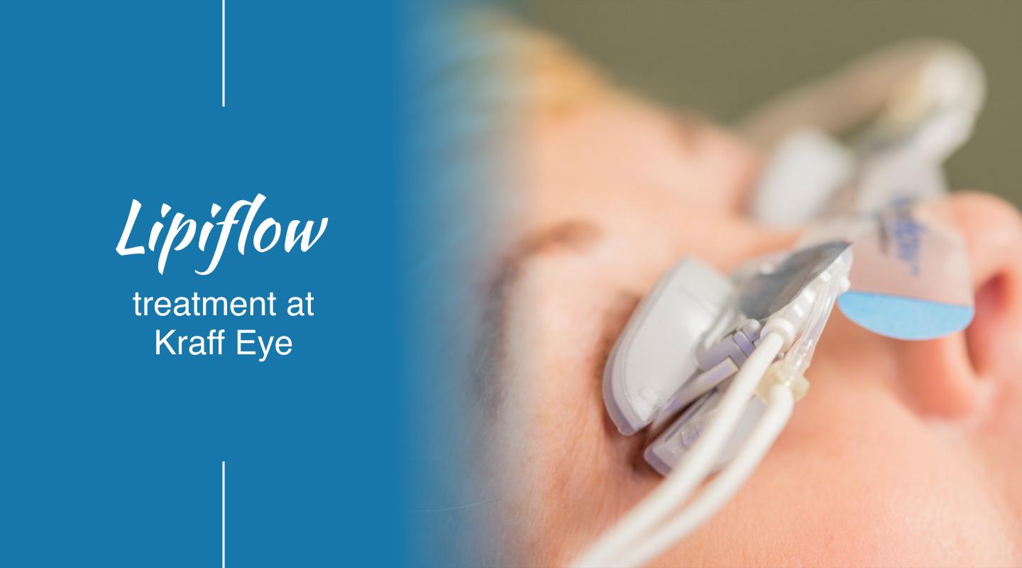 LipiFlow Treatment For Dry Eye & MGD in Chicago | Kraff Eye Institute