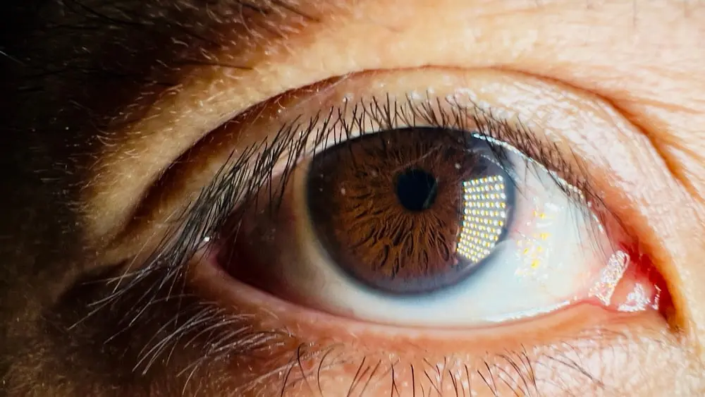 Amblyopia (Lazy Eye) Treatment in Chicago, IL | Kraff Eye Institute