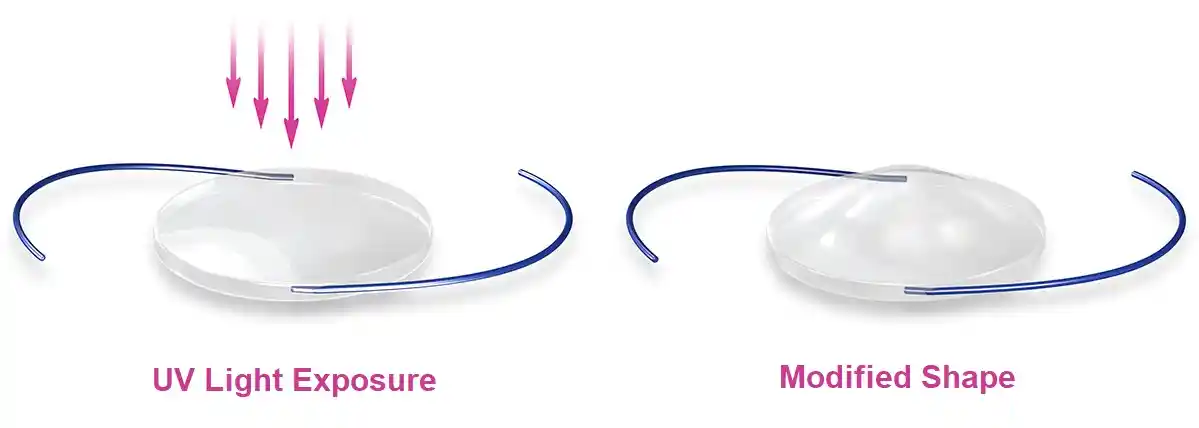 RxSight Light Adjustable Lens Chicago | Kraff Eye Institute