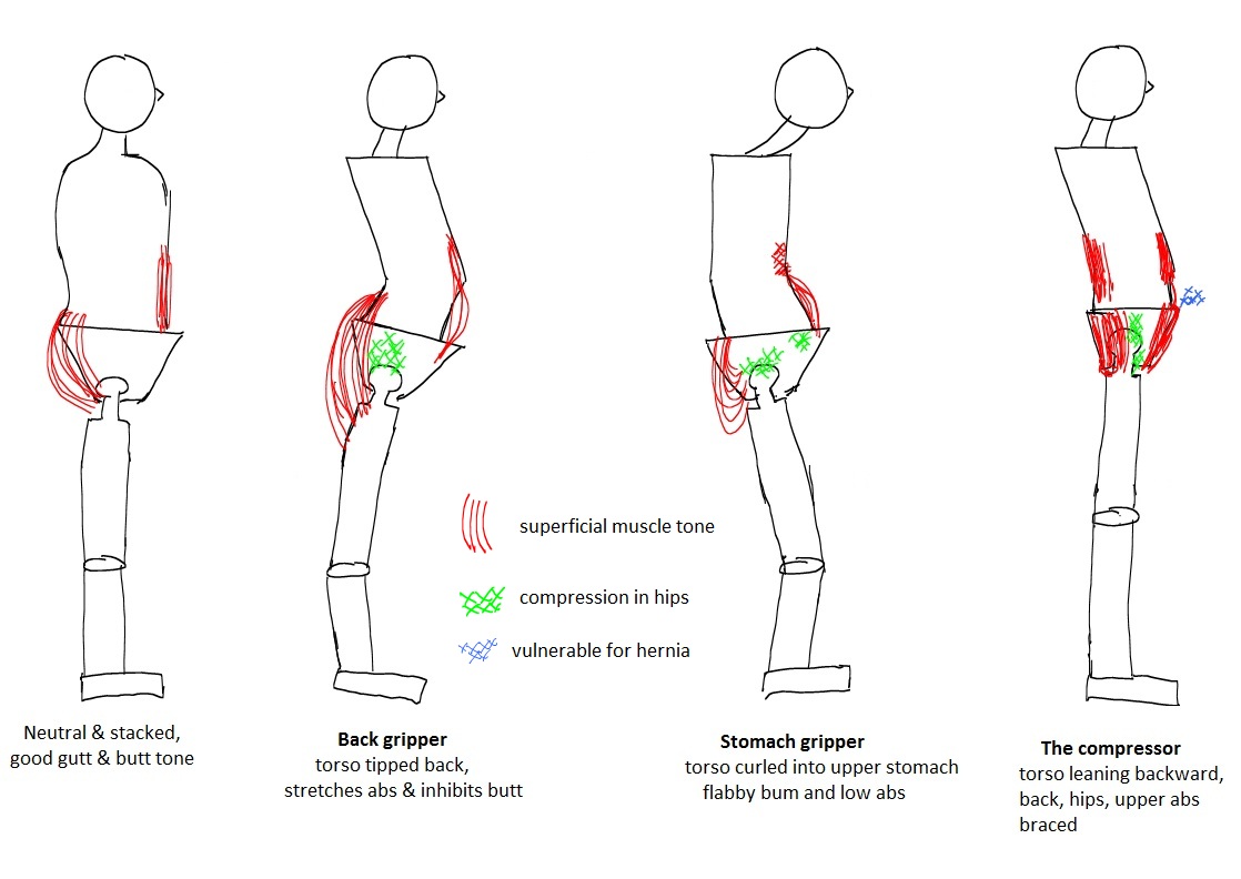 Why Hips Hurt- An illustrated explanation | WhyThingsHurt