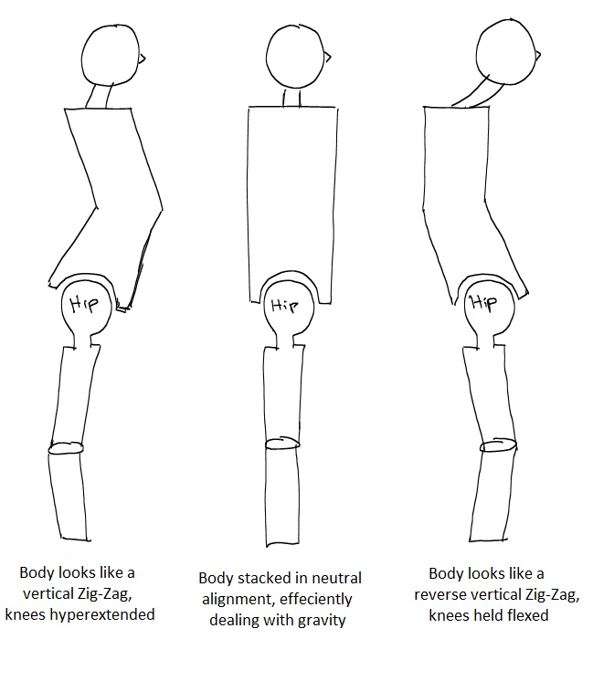 Why Hips Hurt- An illustrated explanation | WhyThingsHurt
