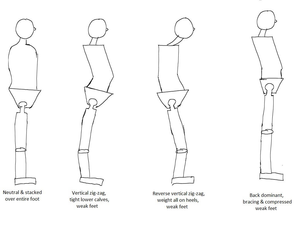 Why Hips Hurt- An illustrated explanation | WhyThingsHurt