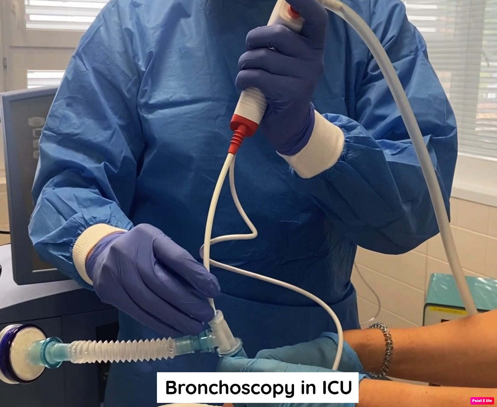 Workflow Blog: Bronchoscopy in ICU