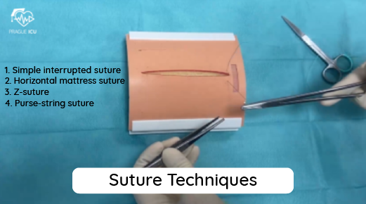 Workflow Blog: Suture techniques