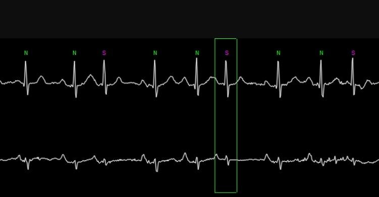 Prague ICU