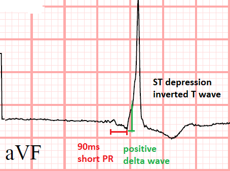 Prague ICU