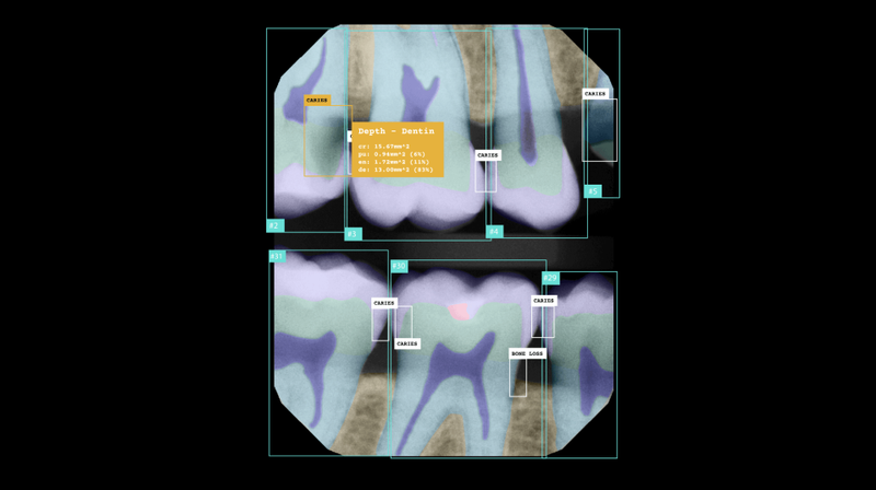 Pearl - The future of dentistry, powered by dental AI.
