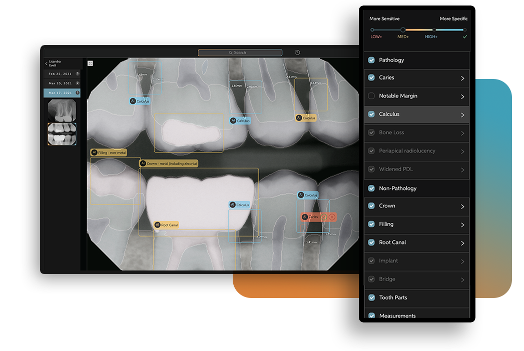 Second Opinion - Real-time pathology detection aid for dentists, from ...
