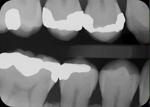 Perfecting Case Presentation with Real-Time AI Assistant | Pearl