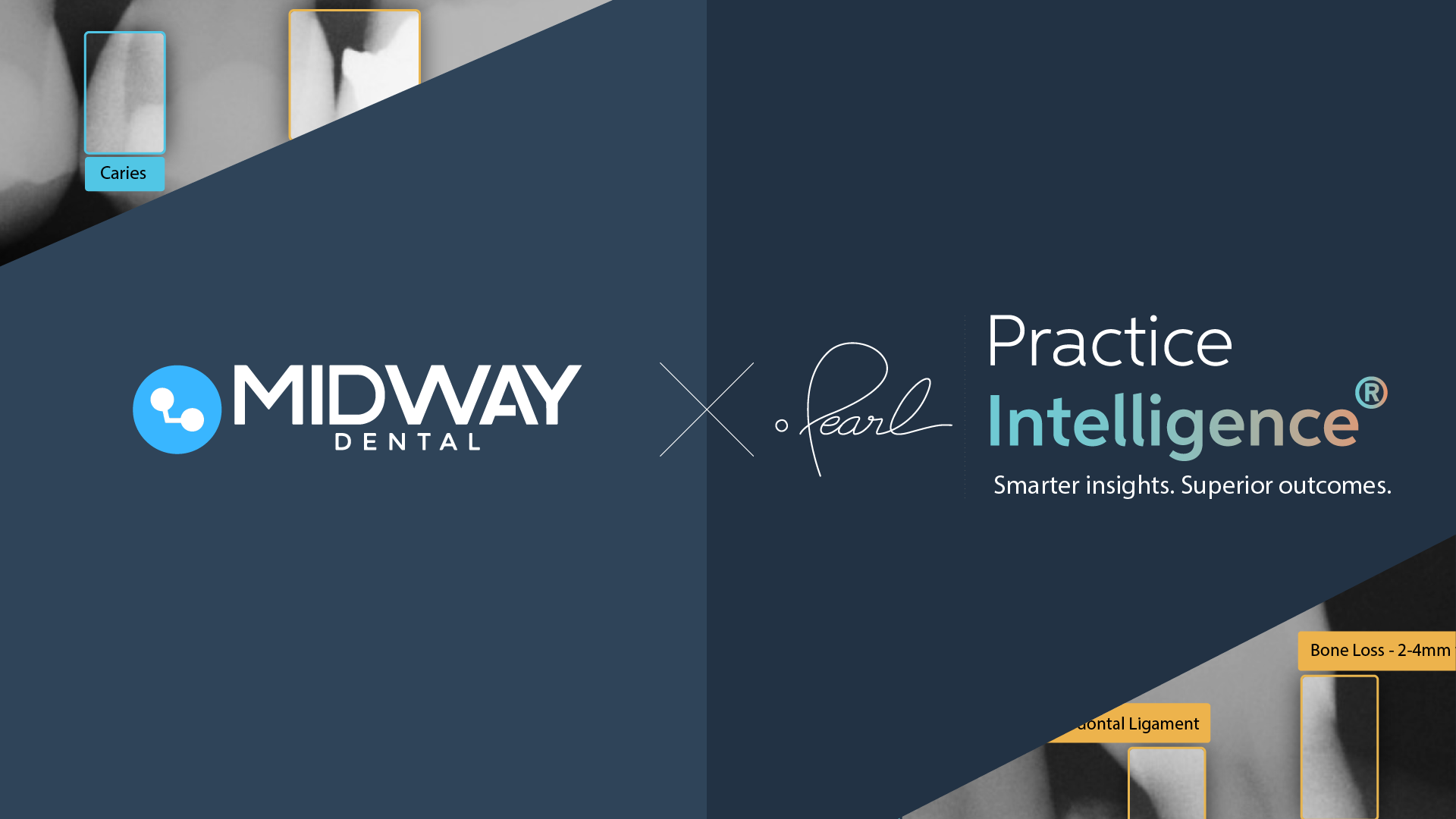 Midway Dental Supply Partners with Dental AI Leader Pearl