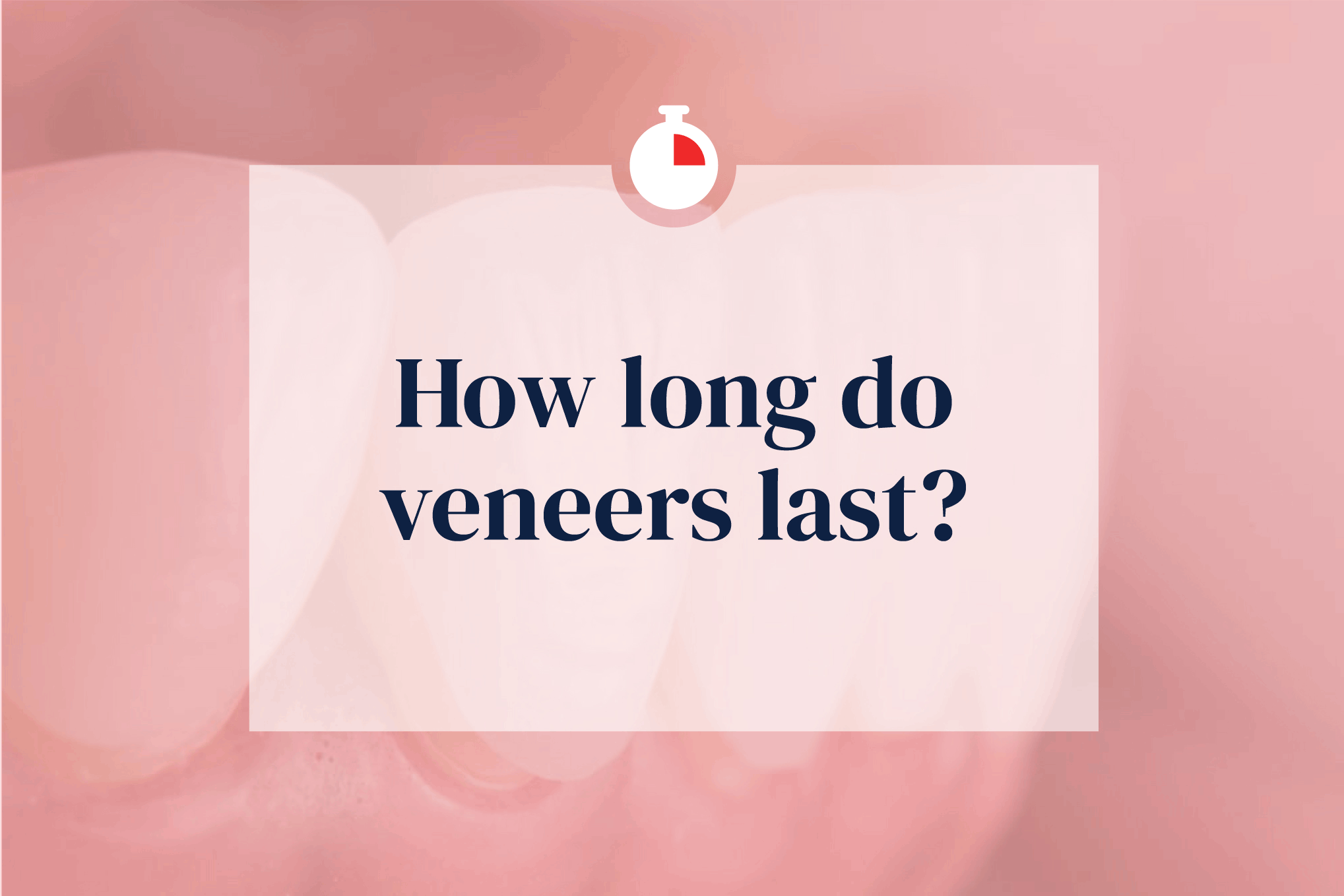 Trident Smiles Dental How Long Do Veneers Last Learn All About