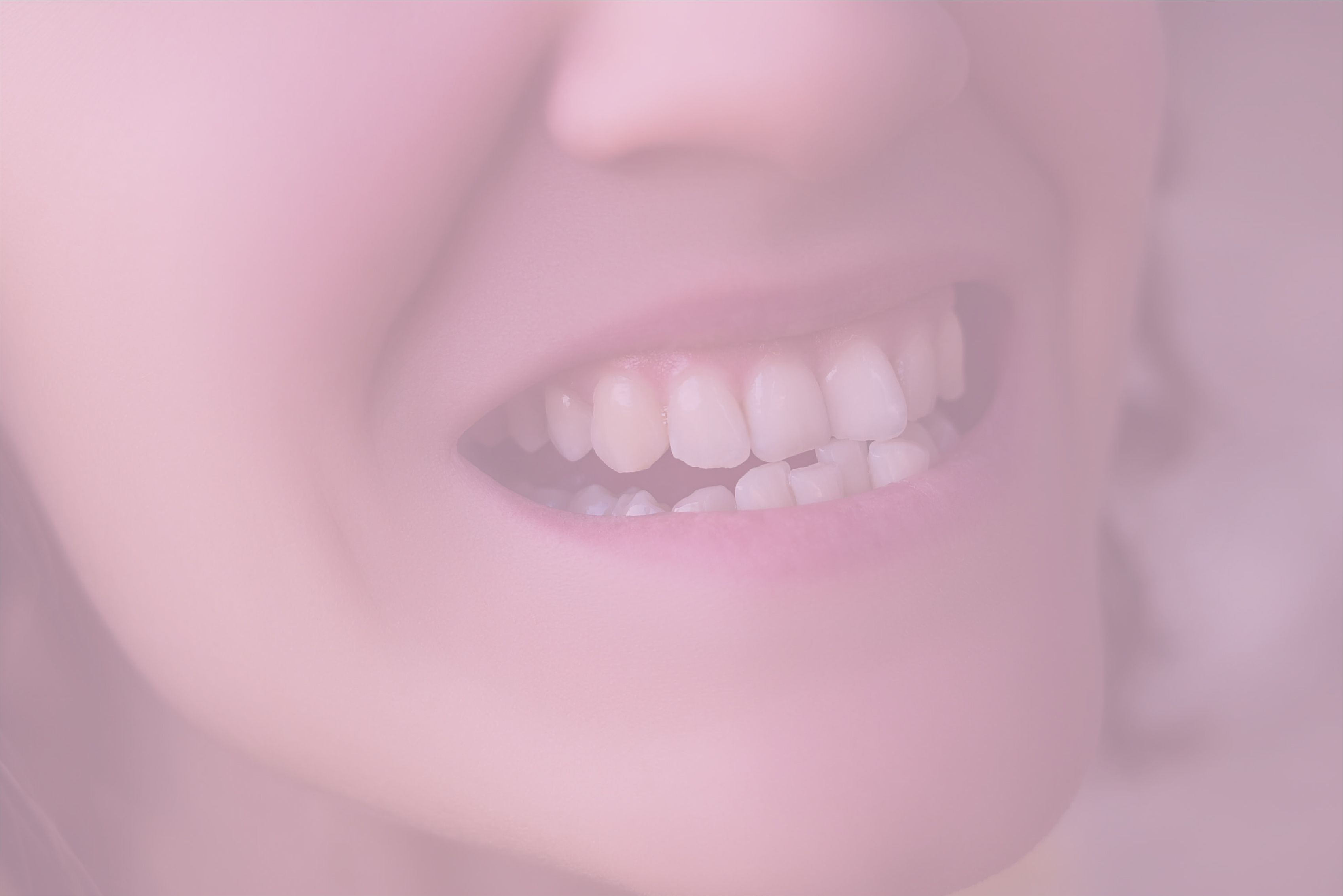 Trident Smiles Dental | Can Invisalign Correct Crowding in Teeth?