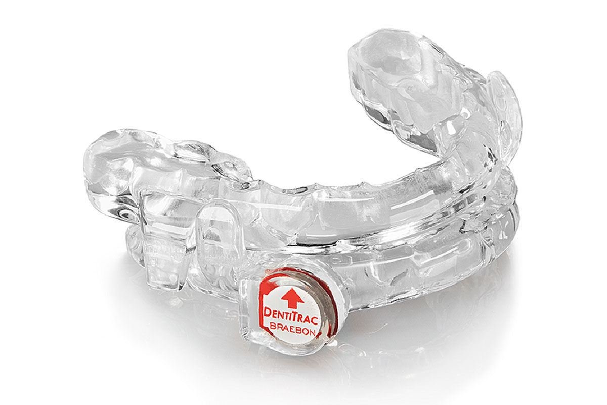 MAD for Sleep Apnea: Effectiveness Research | BlueSleep