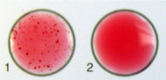 Staph test procedure | Arlington Scientific