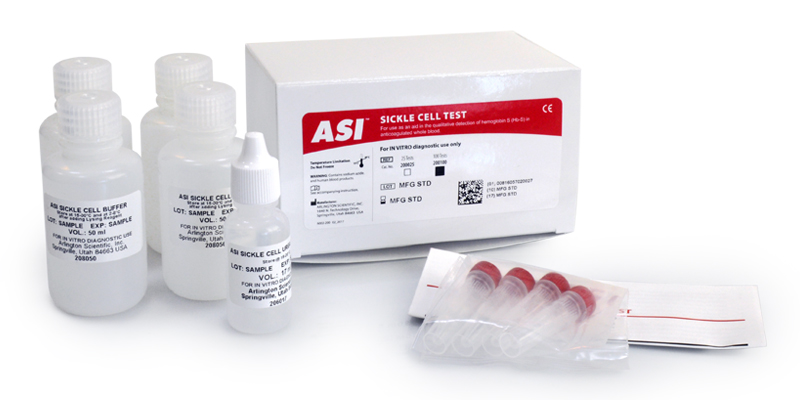 Sickle Cell Test | Arlington Scientific