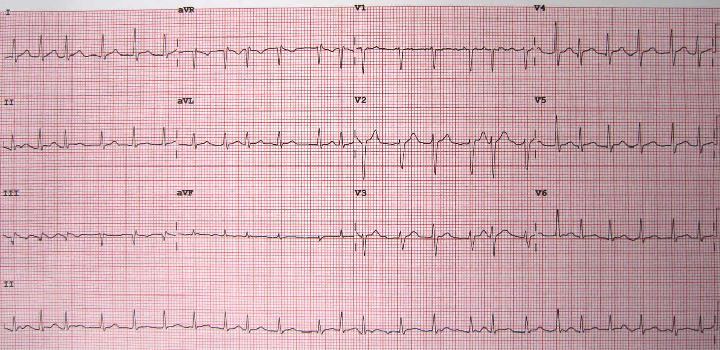 Electrocardiography (ECG) — Medistudents