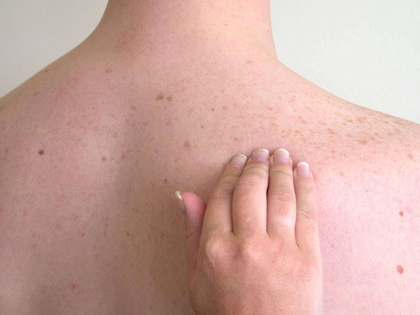 Shoulder Examination — Medistudents