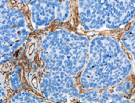 Conozca al marcador: CD54 (ICAM­1)