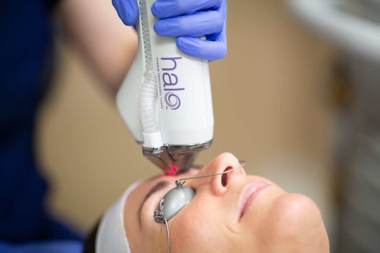 Skin Laser Treatments | Skincredible Dermatology & Surgery